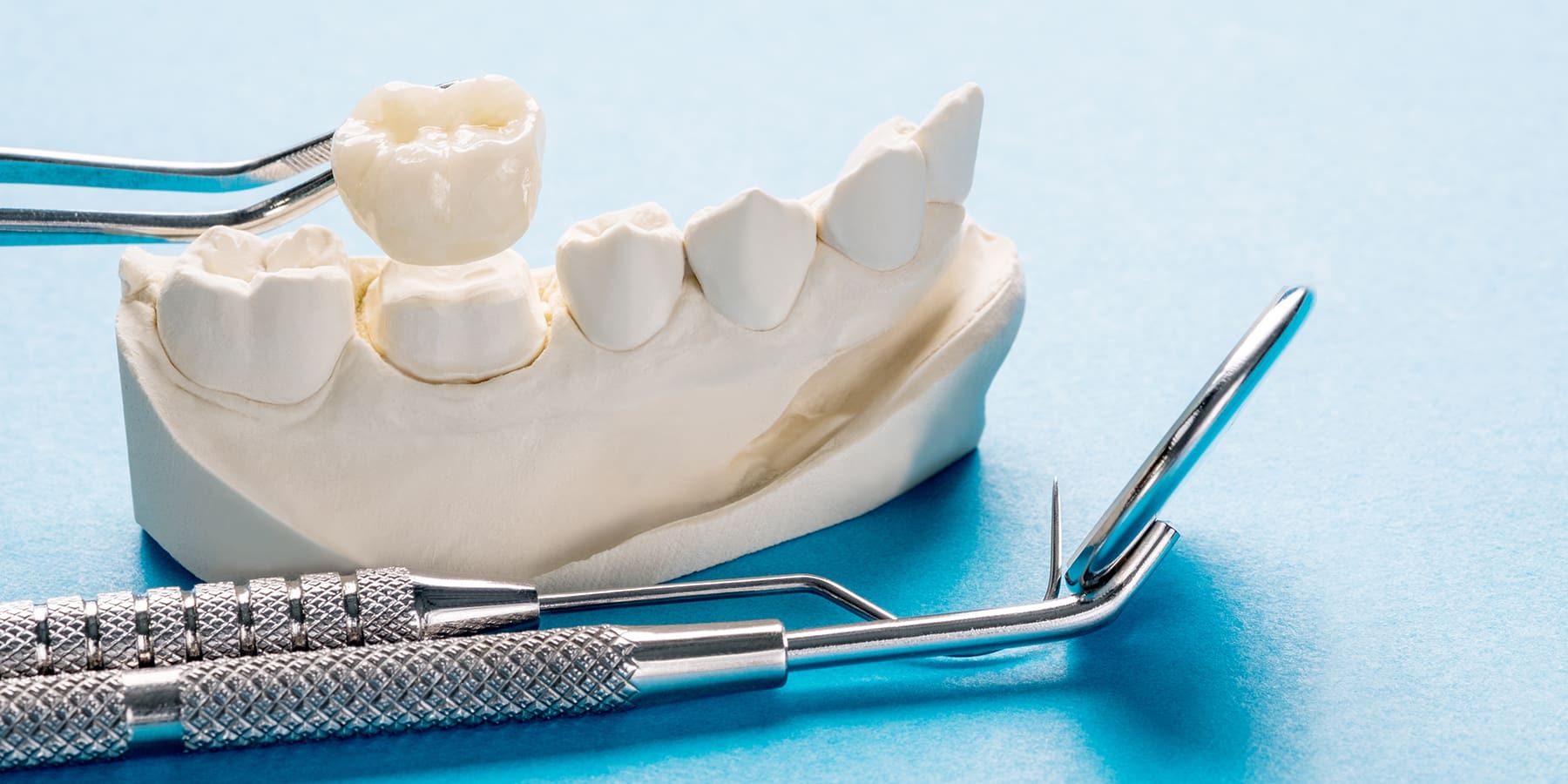 Fixed and removable prosthodontics | Morris Dental Solutions